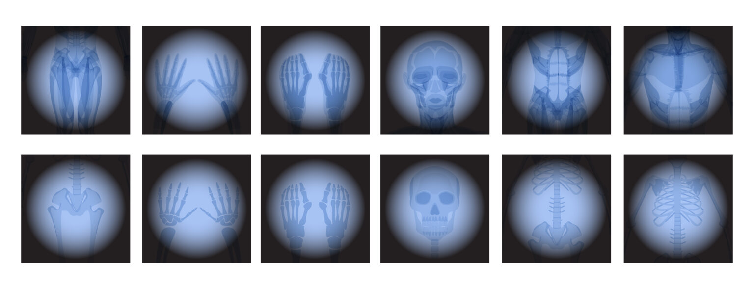 Understanding right X-ray Imaging: Types, Uses & Technology