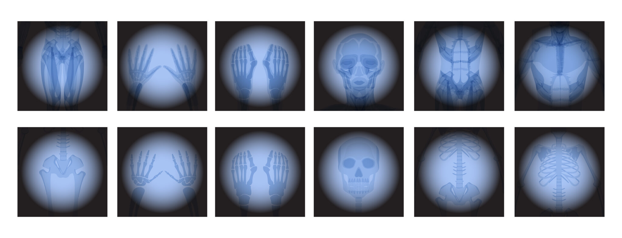 Understanding right X-ray Imaging: Types, Uses & Technology